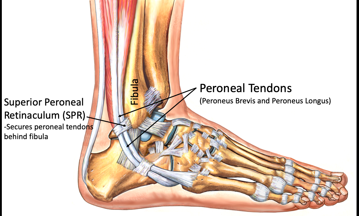 Peroneal Tendinopathy Range Physiotherapy Peroneal Tendinopathy Range Physiotherapy